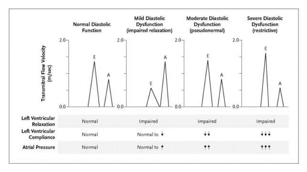 LV Size and Function – Cardio Guide