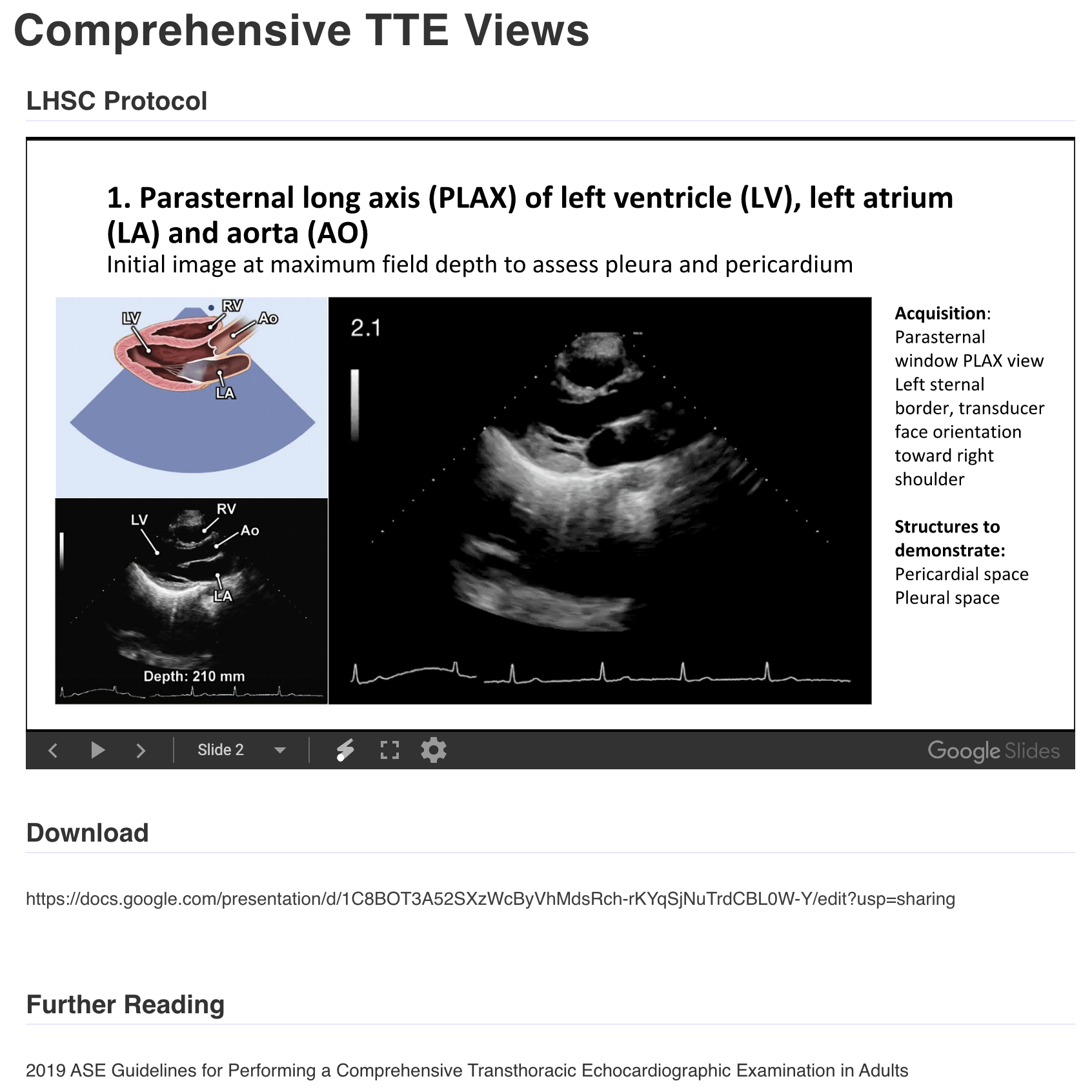 POCUS - Cardio Guide