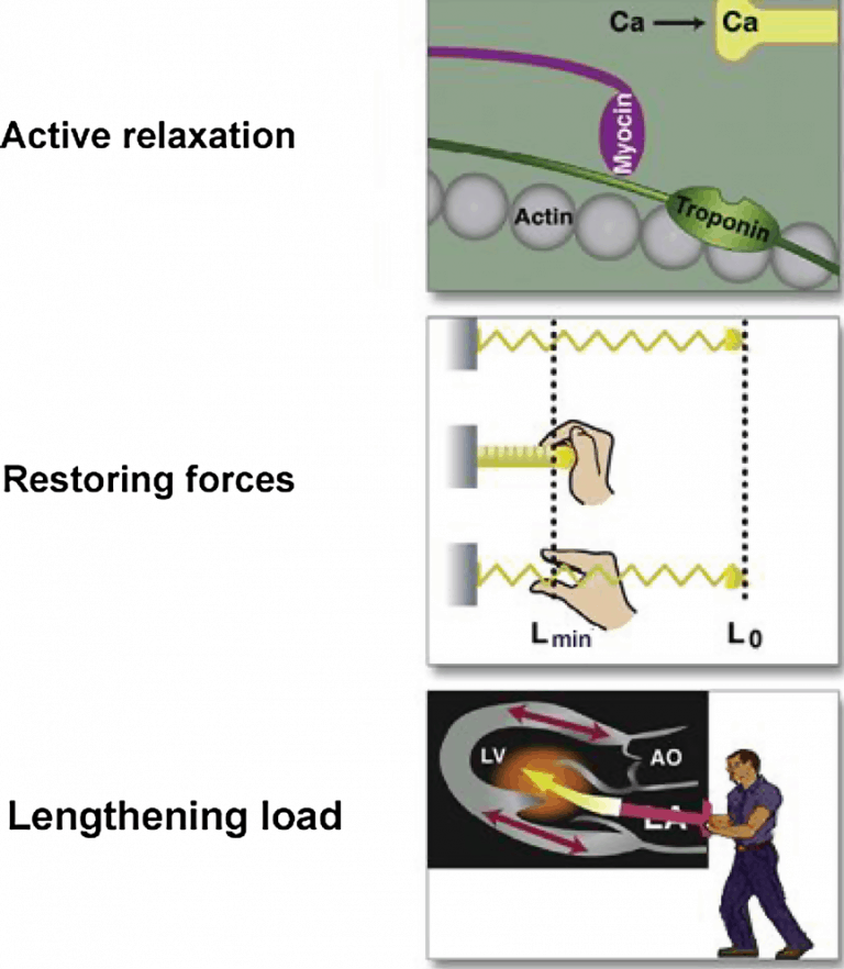 LV Size and Function – Cardio Guide