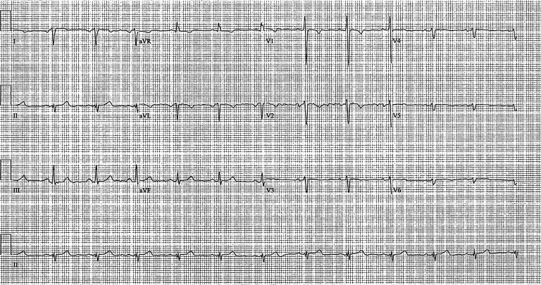 Dextrocardia - Cardio Guide