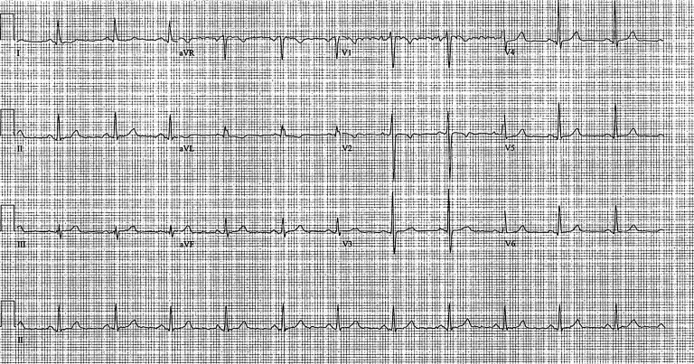 Dextrocardia - Cardio Guide