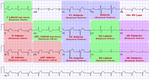 ECG Lead Placement - Cardio Guide