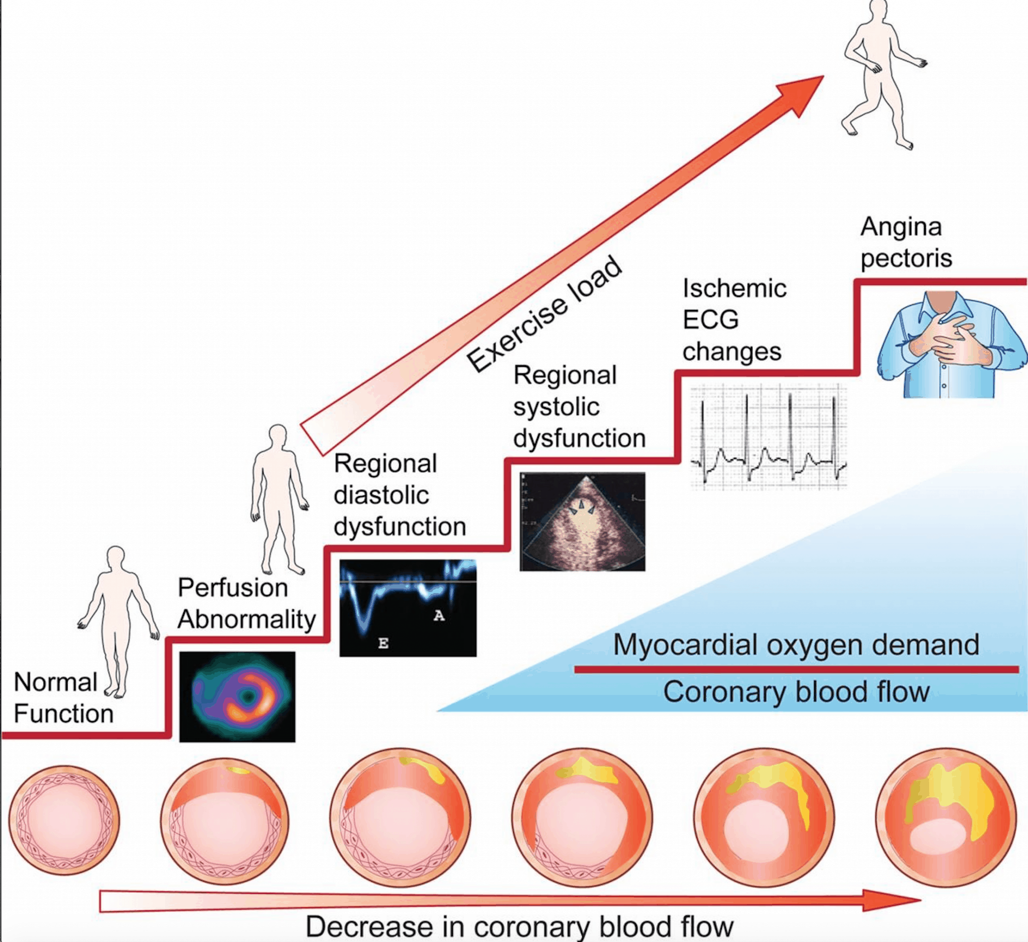 Stable CAD – Cardio Guide