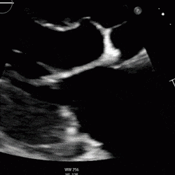 MR Case - Cardio Guide