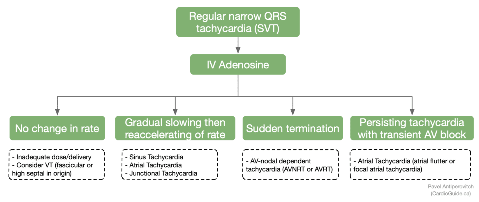 Narrow QRS Tachycardia – Cardio Guide