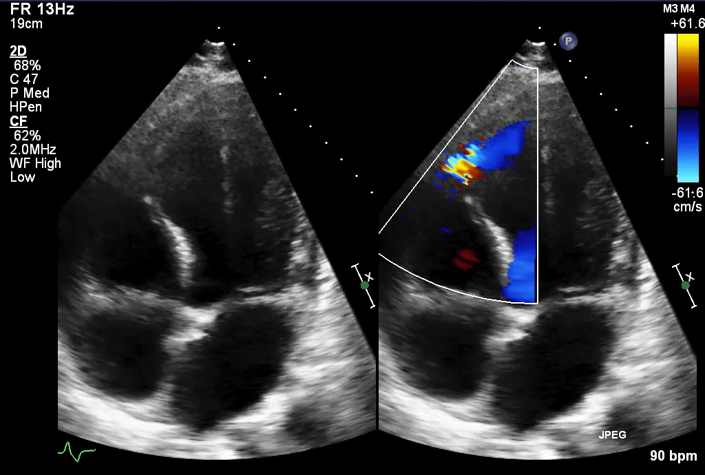 Search Videos – Cardio Guide