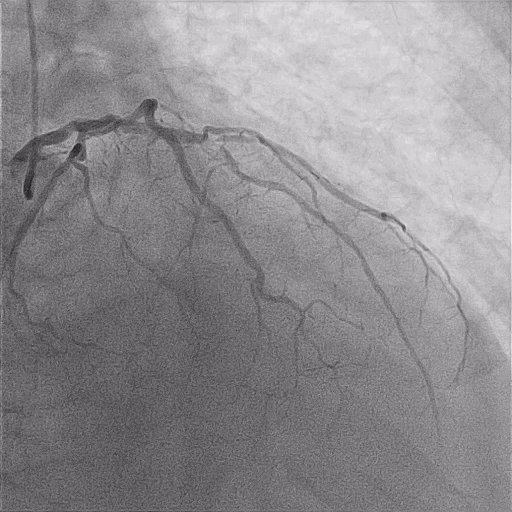 5 RAO Cranial - Cardio Guide
