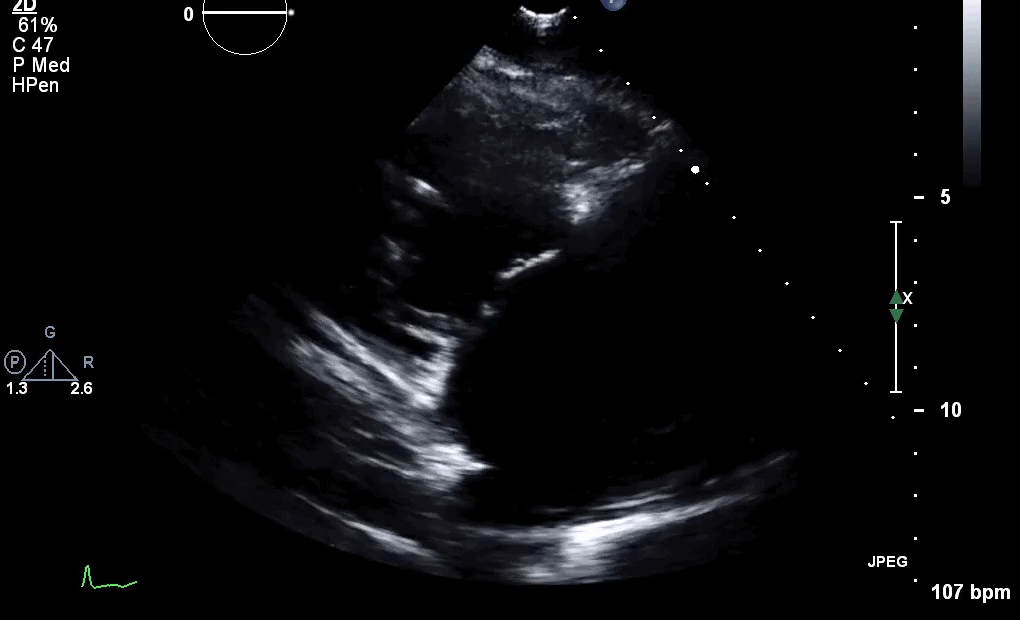 3 RVF PLAX RVIT - Cardio Guide