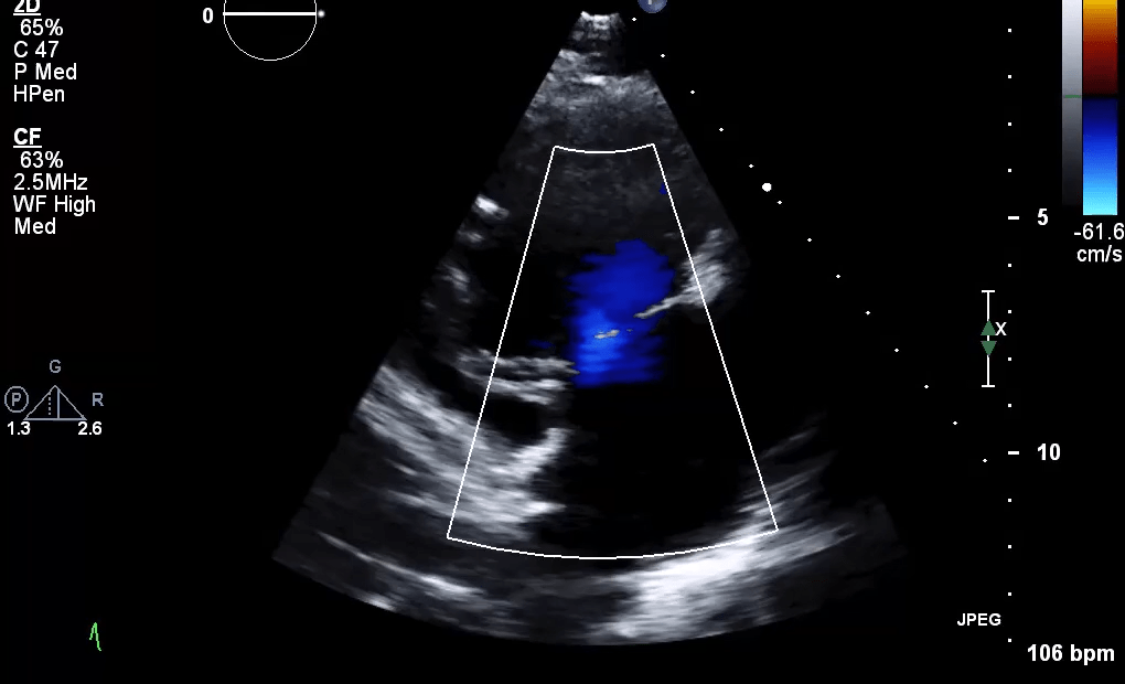 4 RVF PLAX RVIT Colour - Cardio Guide