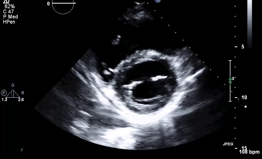 9 RVF PSAX MV - Cardio Guide