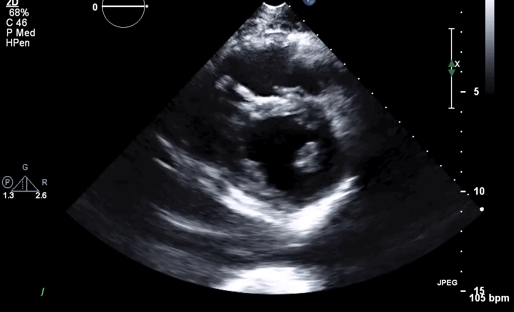 10 RVF PSAX PAP - Cardio Guide