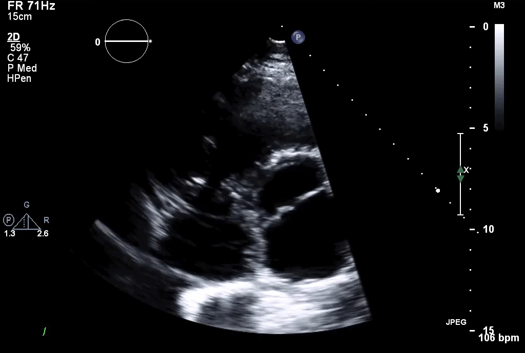 7 RVF PSAX RVIT - Cardio Guide