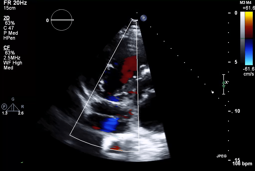 8 RVF PSAX RVIT Colour - Cardio Guide