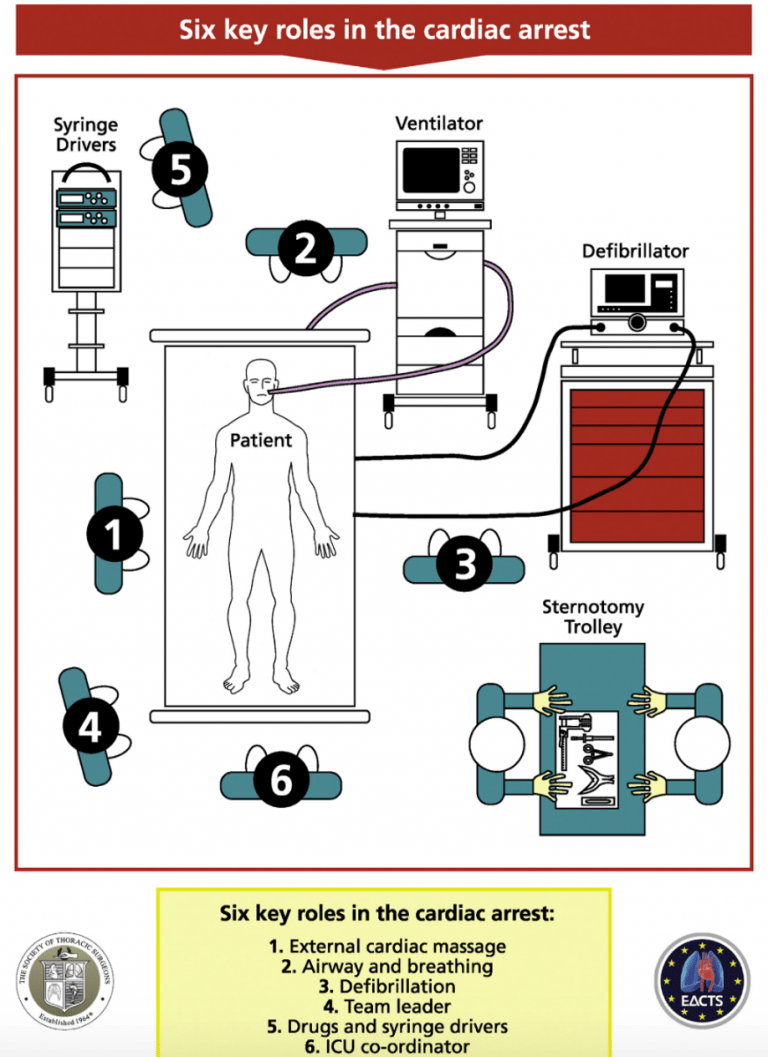 Resuscitation After Cardiac Surgery - Cardio Guide