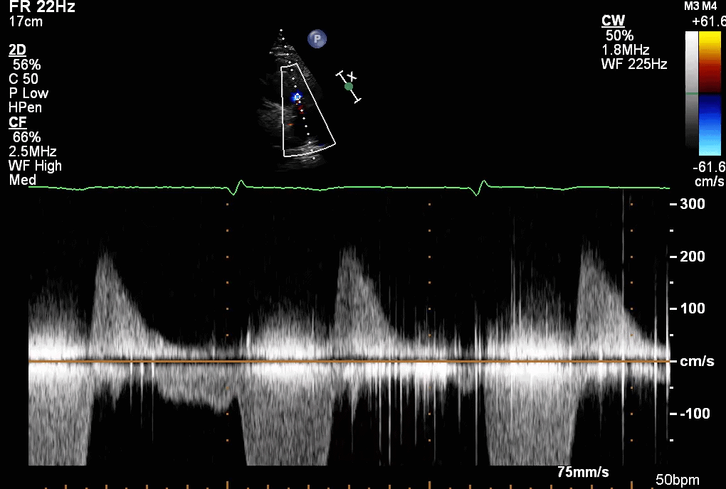 PLAX RVOT CW PR - Cardio Guide