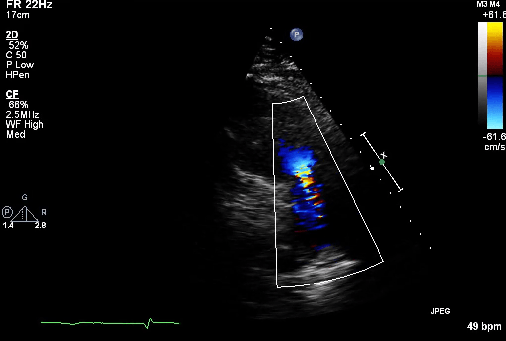 2 PLAX RVOT Colour - Cardio Guide