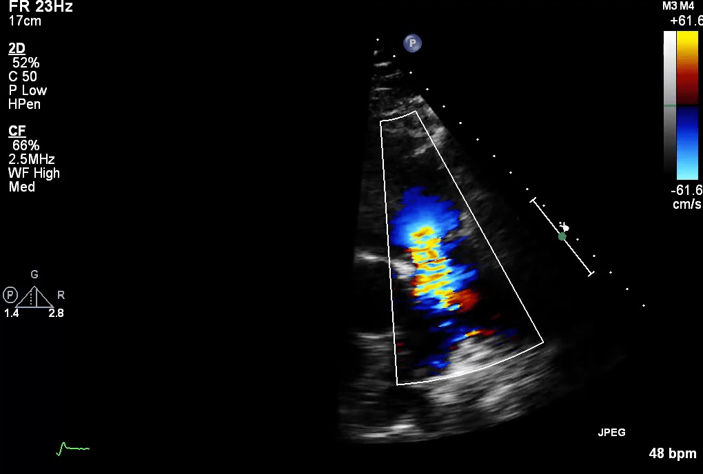PSAX RVOT Colour - Cardio Guide