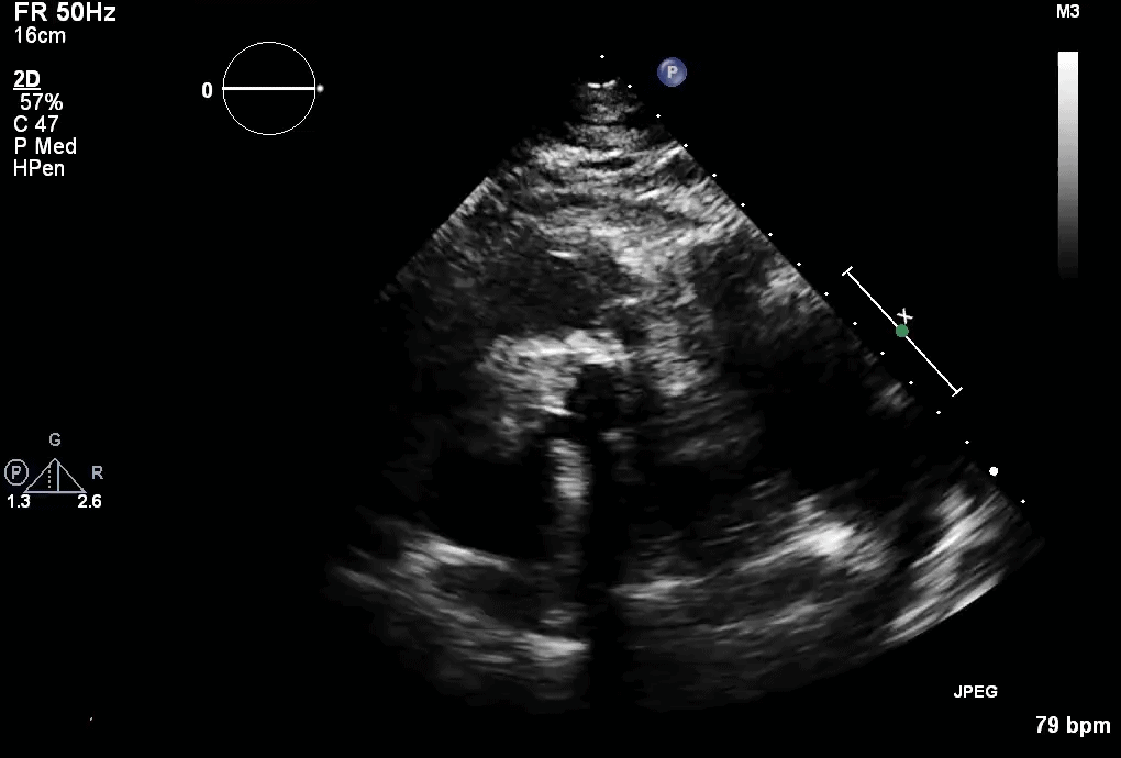 PLAX RVOT - Cardio Guide