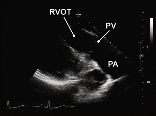 Search Videos – Cardio Guide