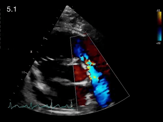 PSAX RVOT Colour - Cardio Guide