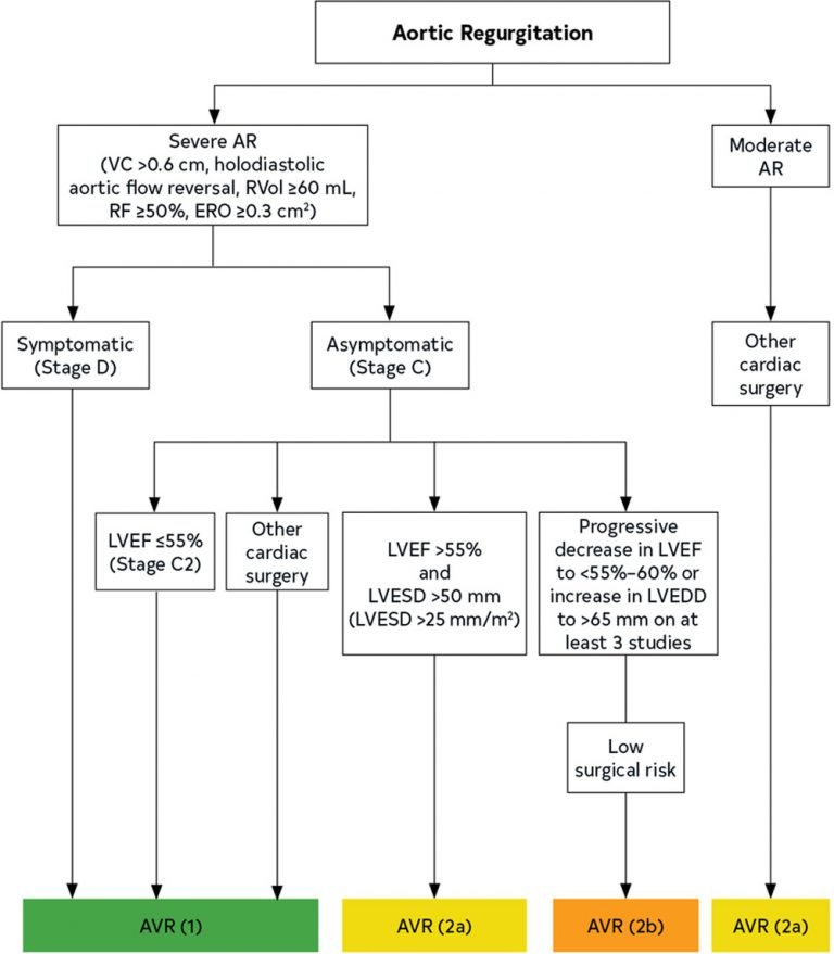 Aortic Regurgitation – Cardio Guide