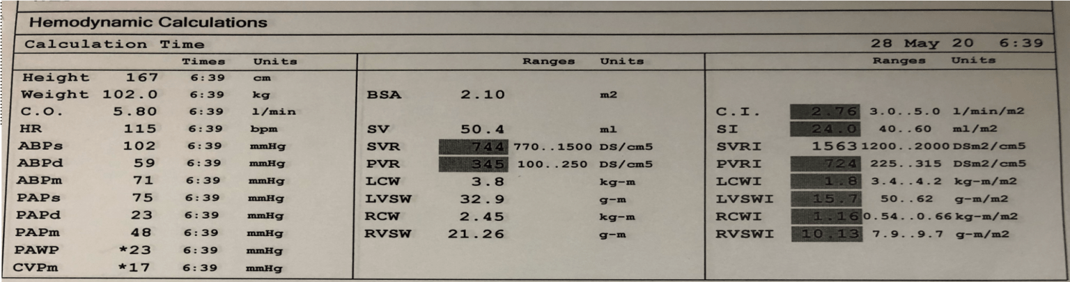 Pulmonary Artery Catheterization – Cardio Guide