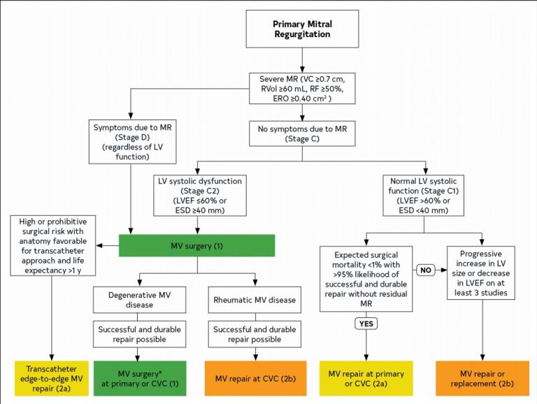 Mitral Regurgitation – Cardio Guide