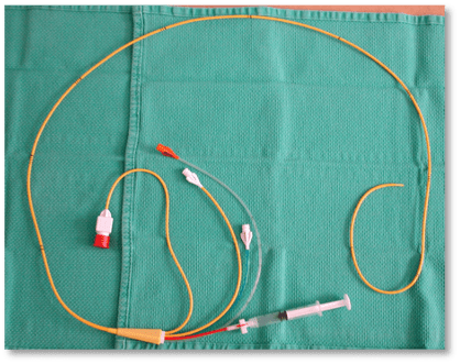 Pulmonary Artery Catheterization – Cardio Guide