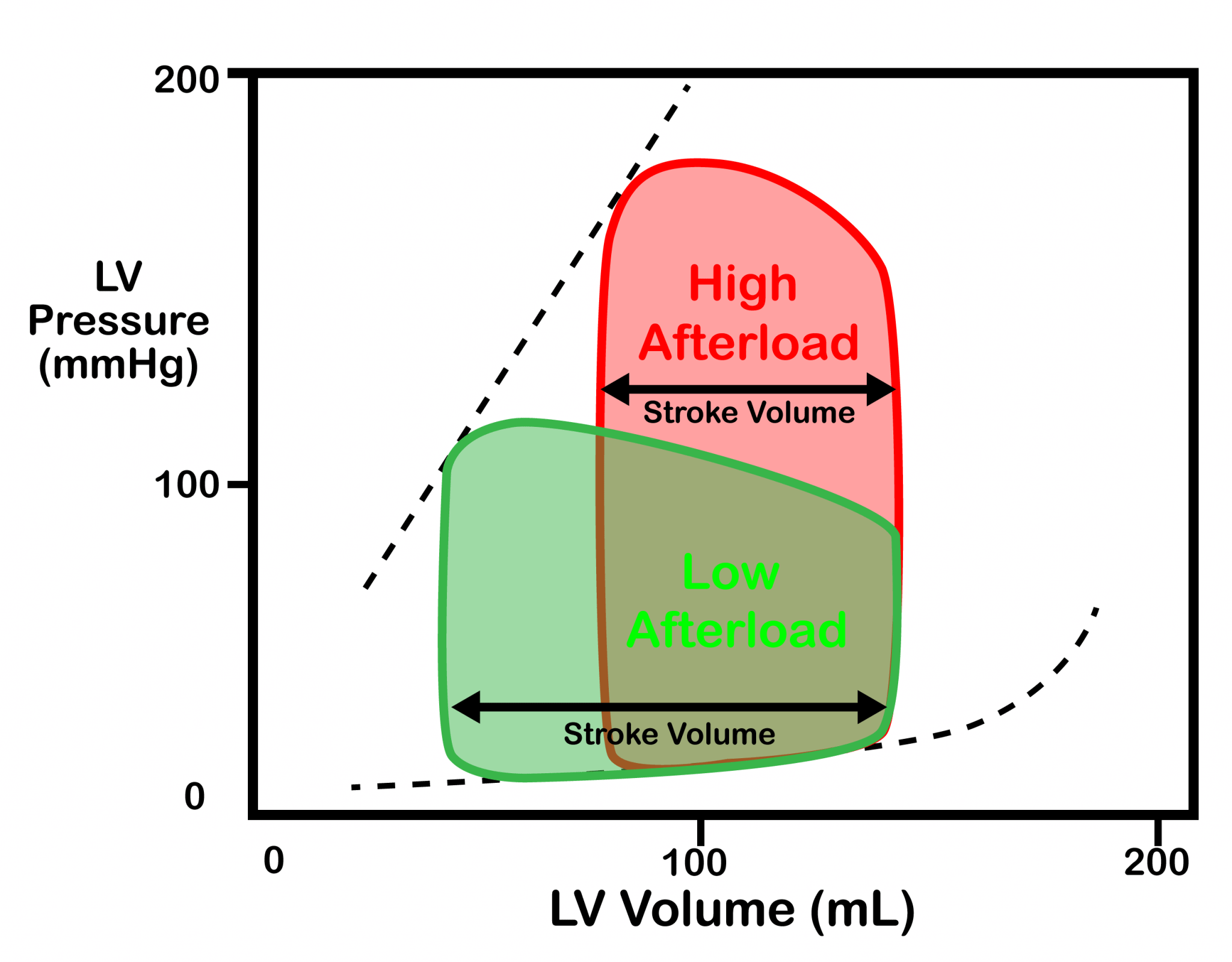 Cardiogenic Shock: Management – Cardio Guide