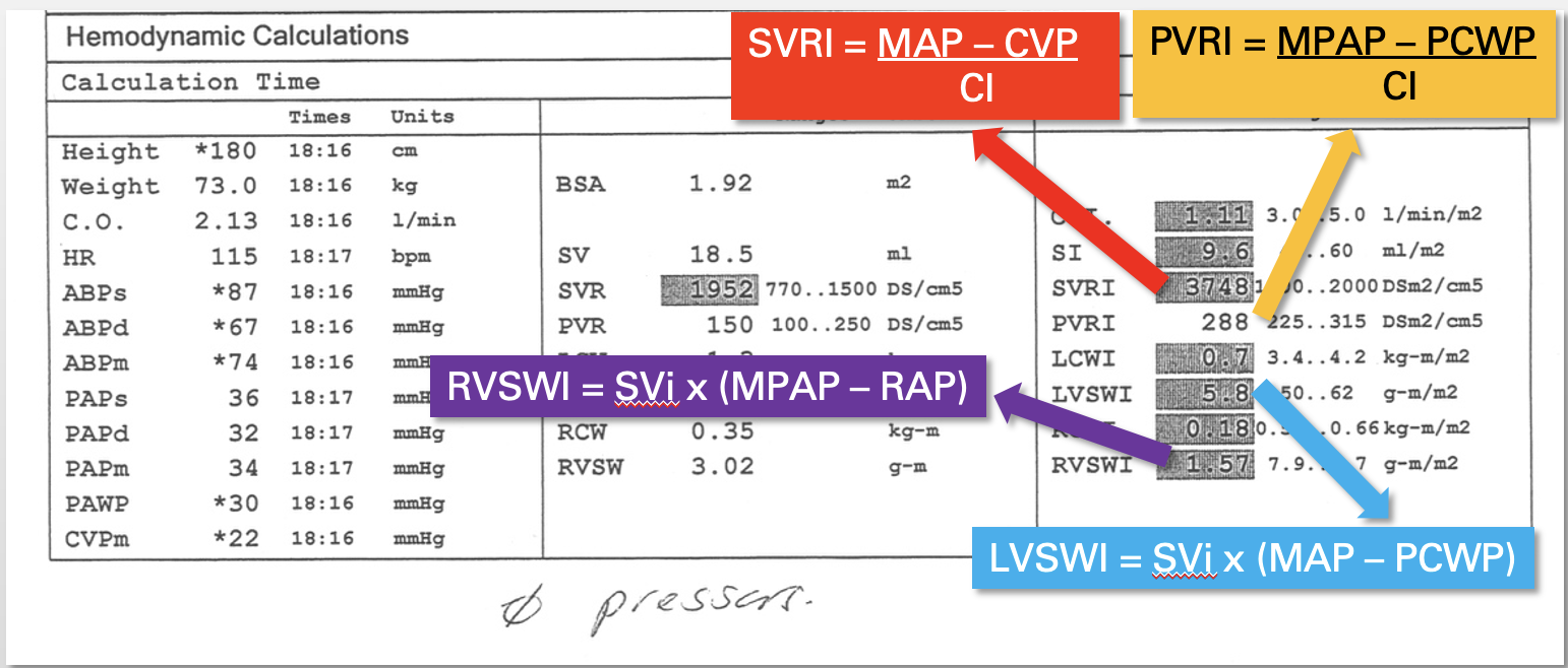 Pulmonary Artery Catheterization – Cardio Guide