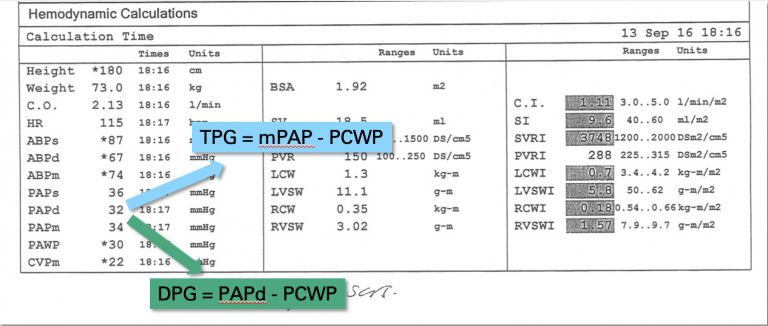 Pulmonary Artery Catheterization – Cardio Guide
