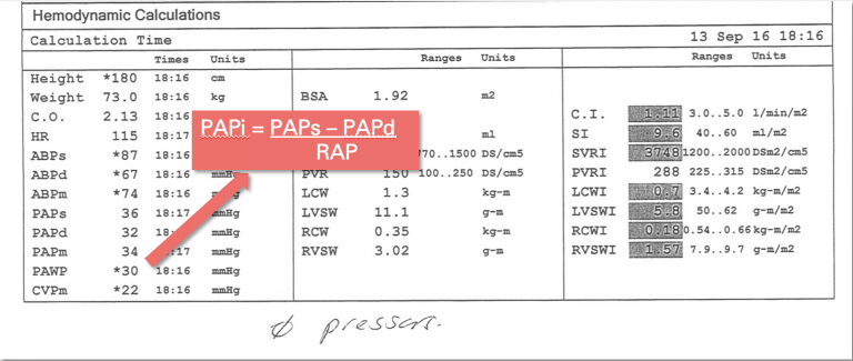 Pulmonary Artery Catheterization – Cardio Guide