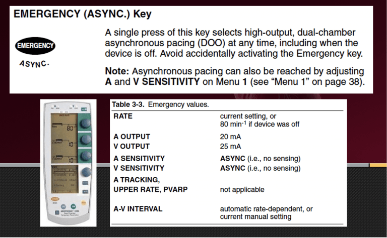 Temporary Pacing – Cardio Guide