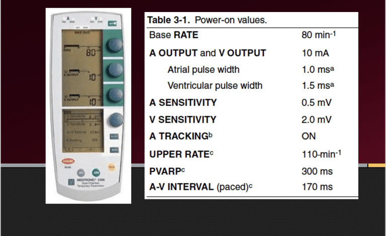 Temporary Pacing – Cardio Guide