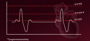Temporary Pacing – Cardio Guide