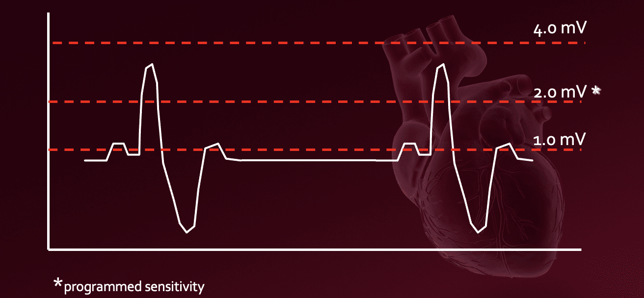 Temporary Pacing – Cardio Guide
