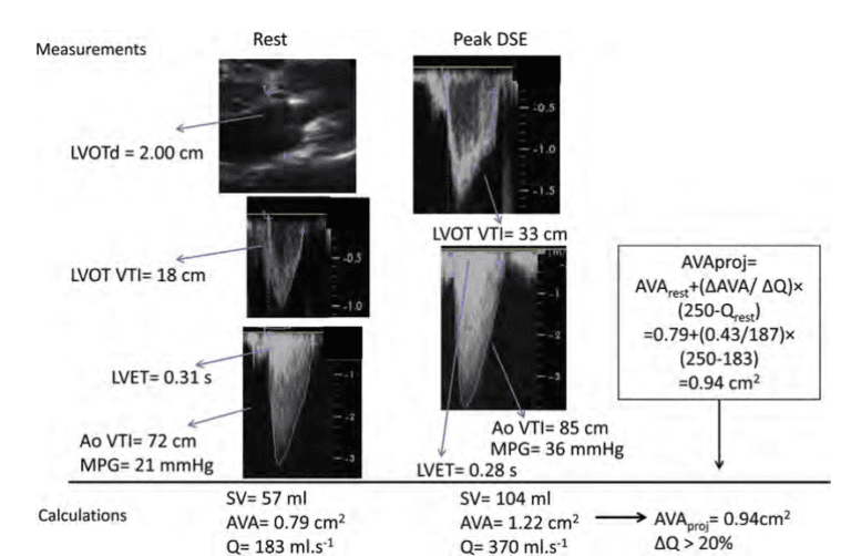 Cardiology Calculators - Cardio Guide